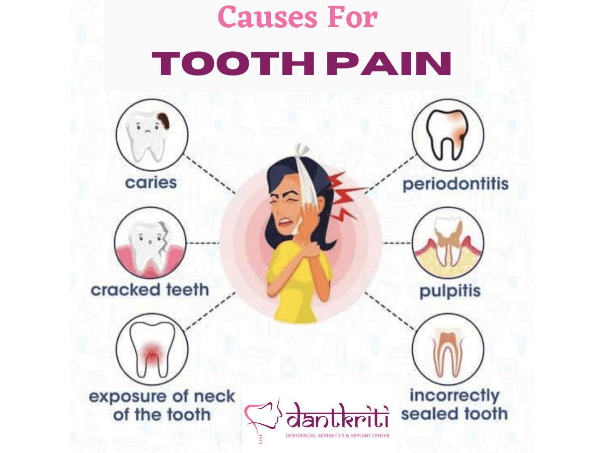Treat Your Tooth Pain Without Pain: Toothache Causes And Treatment In ...