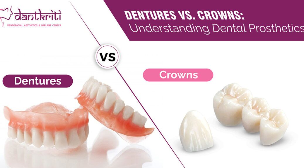 Dentures Vs. Crowns: Understanding Dental Prosthetics | Dantkriti ...